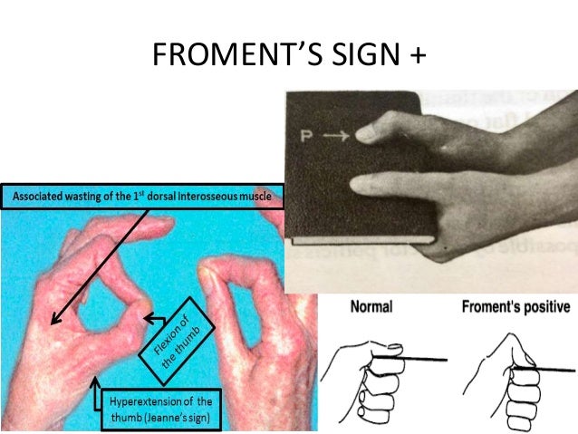 Leprosy tests by aseem
