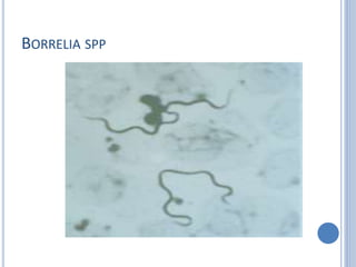 Leptospirosis and Borrelia infection.ppt