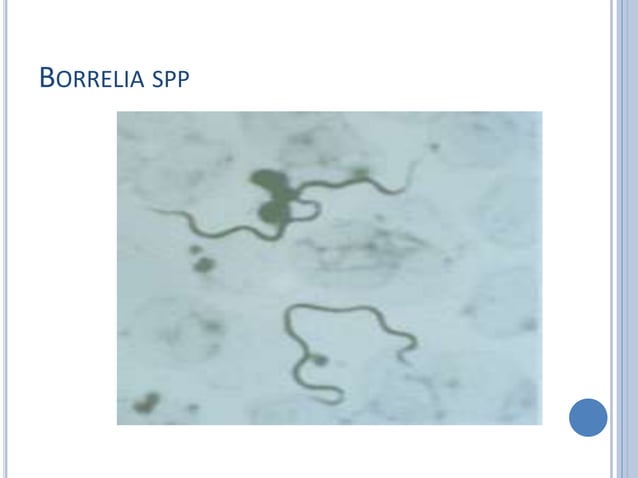 Leptospirosis and Borrelia infection.ppt