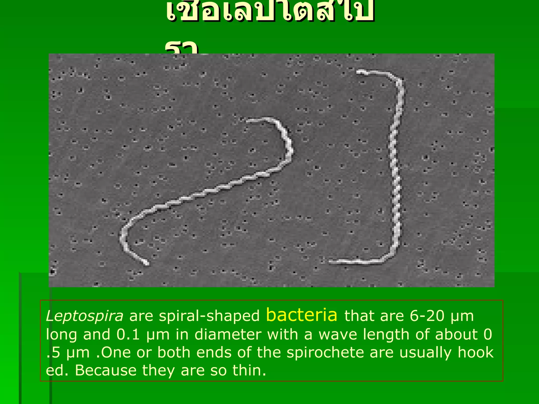 Leptospirosis | PPT