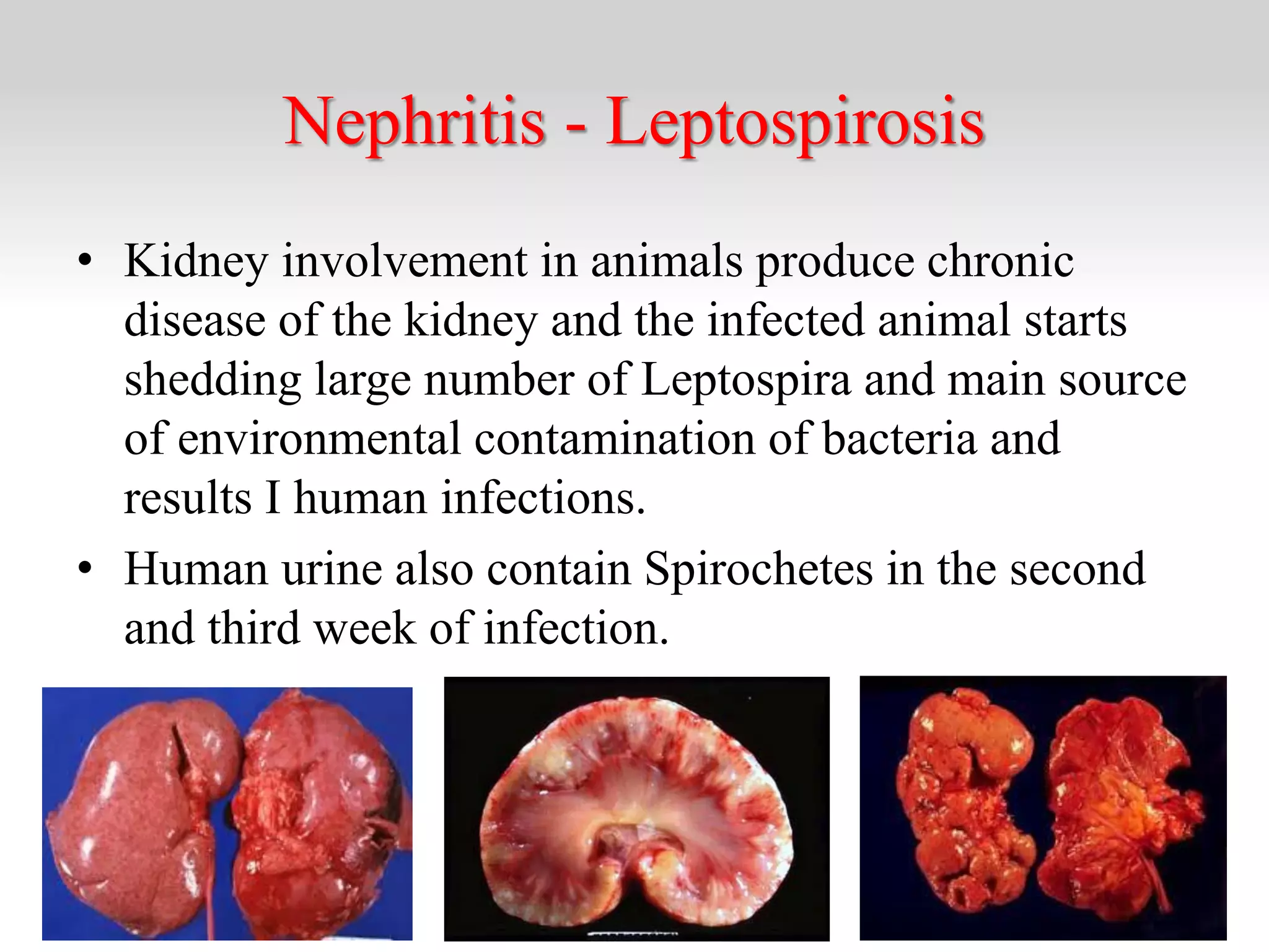 Leptospirosis | PDF