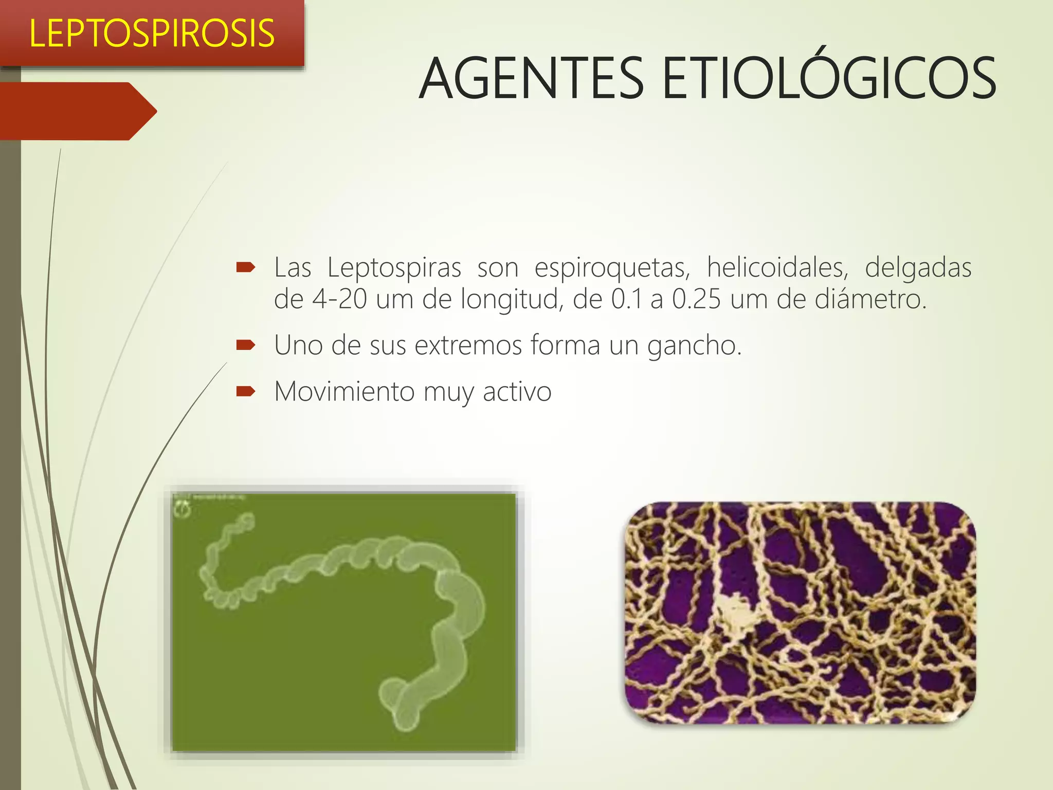 Leptospirosis | PPT | Descarga Gratuita