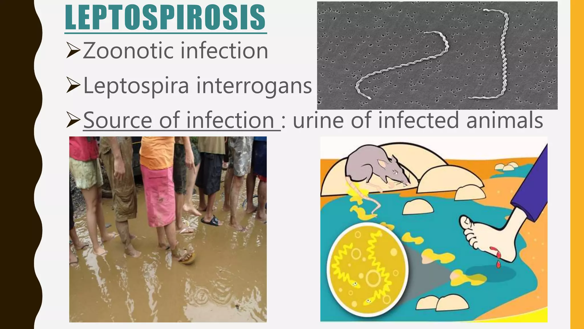 Leptospirosis | PPTX