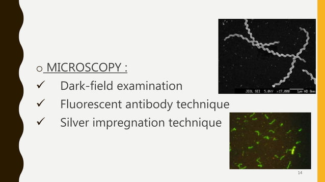 Leptospirosis | PPT