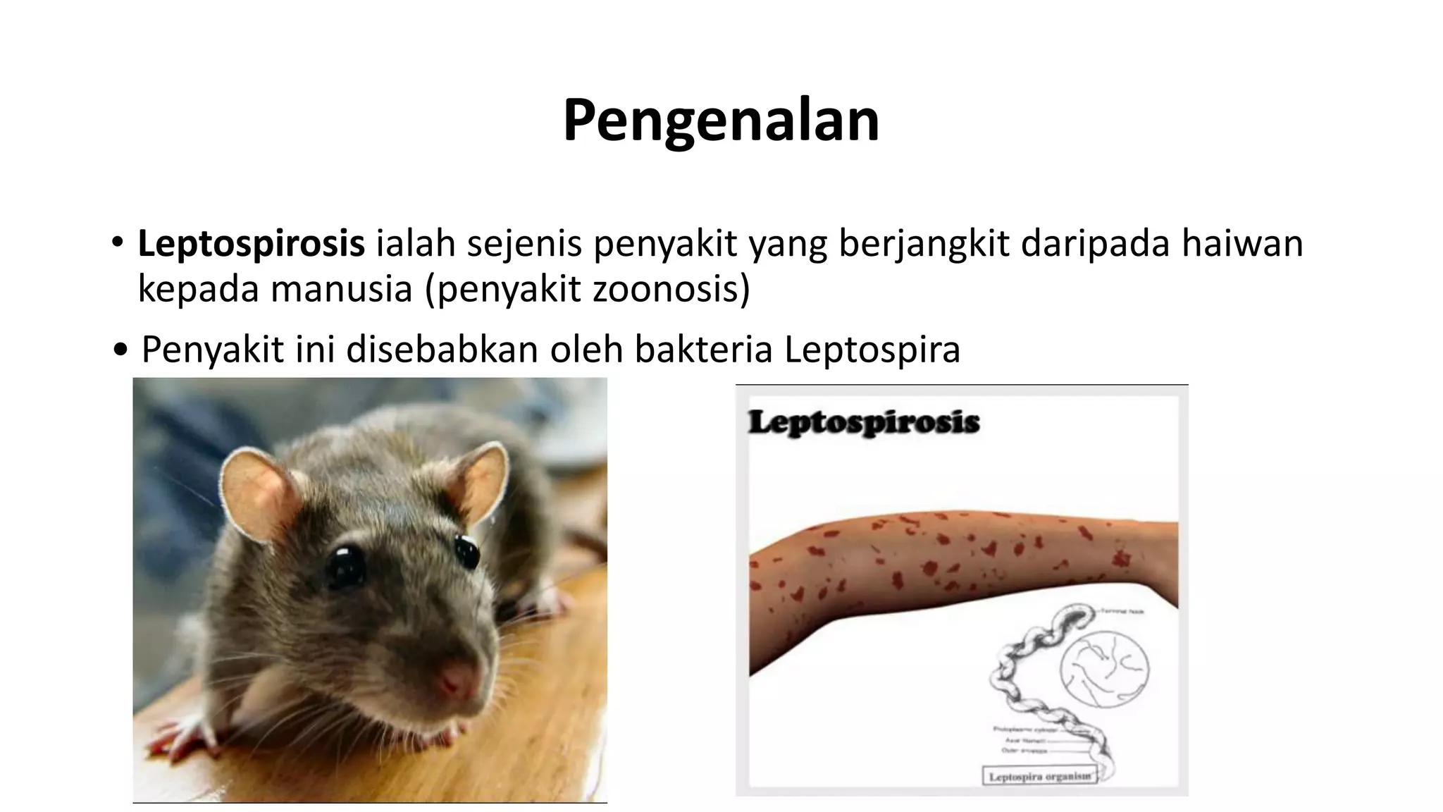 PENYAKIT LEPTOSPIROSIS DI MALAYSIA | PPTX