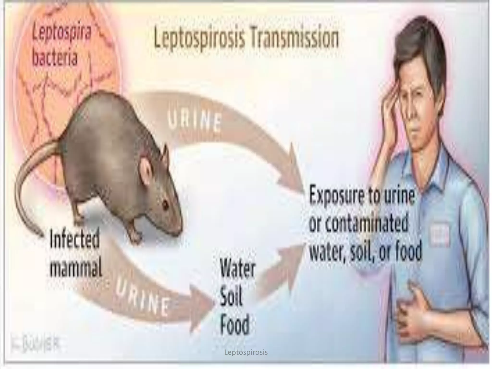 Leptospirosis | PPTX