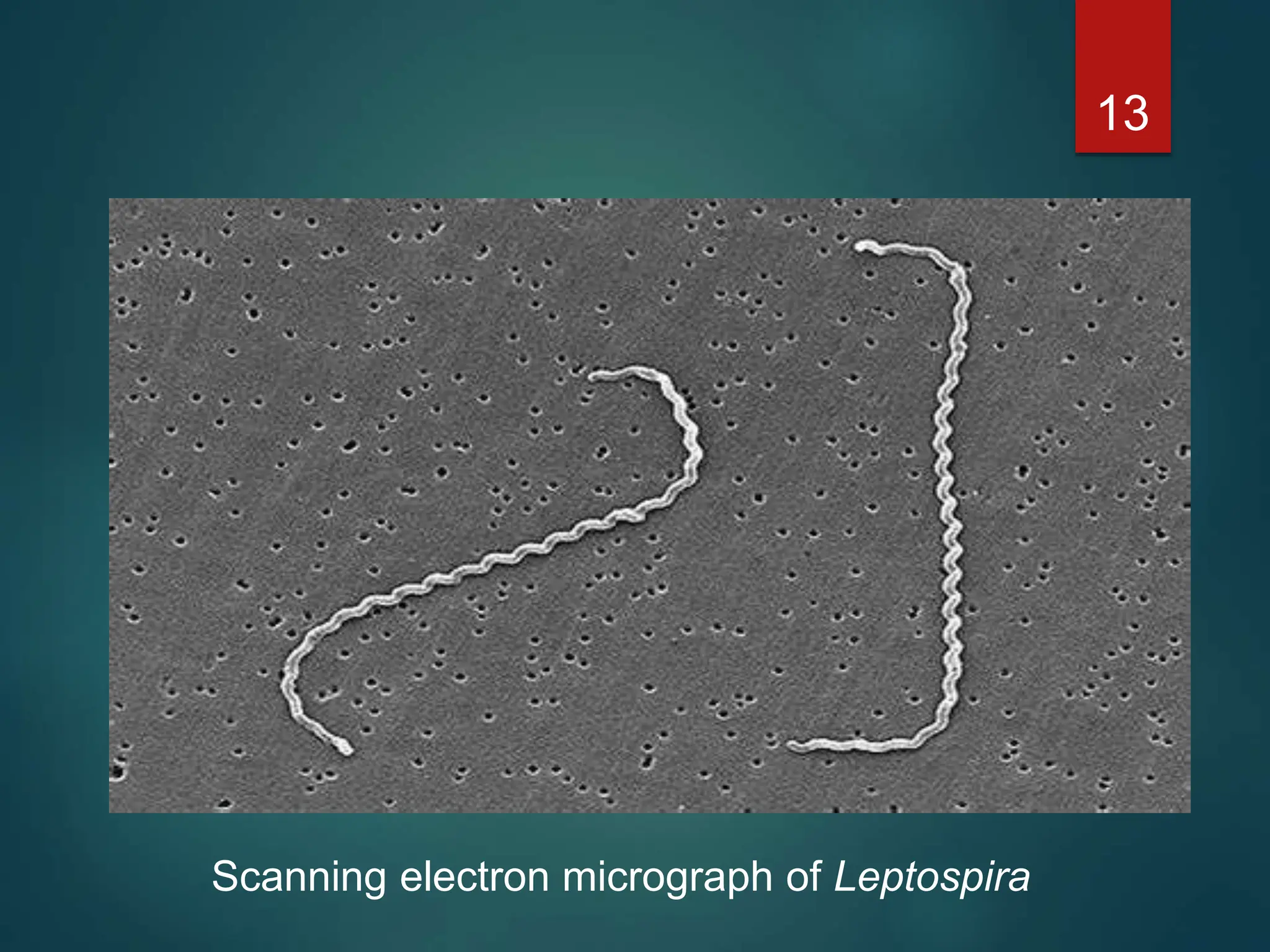 Leptospirosis.pptx | Infectious Diseases | Diseases and Conditions