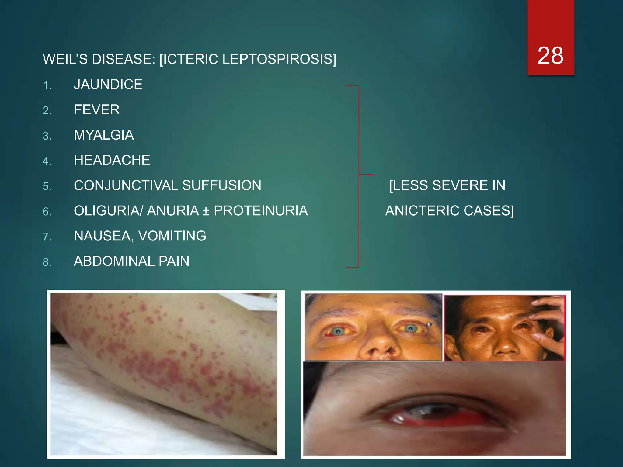 Leptospirosis.pptx