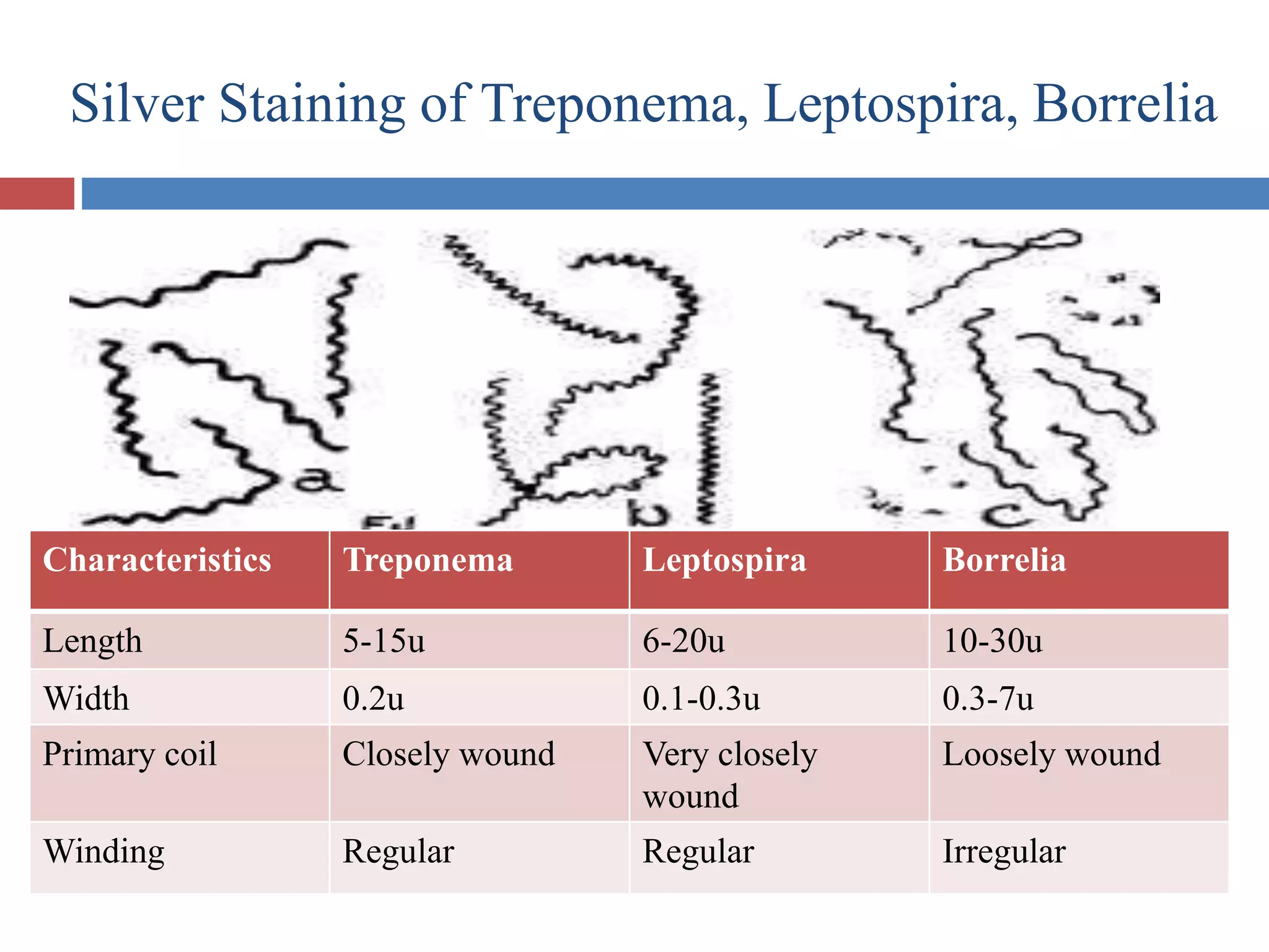 Leptospirosis (1).ppt