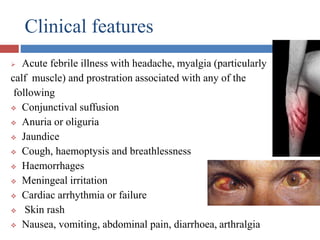 Leptospirosis (1).ppt