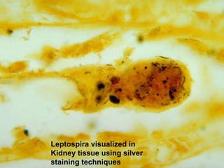 LeptospirosisbyDrPreetShah.ppt