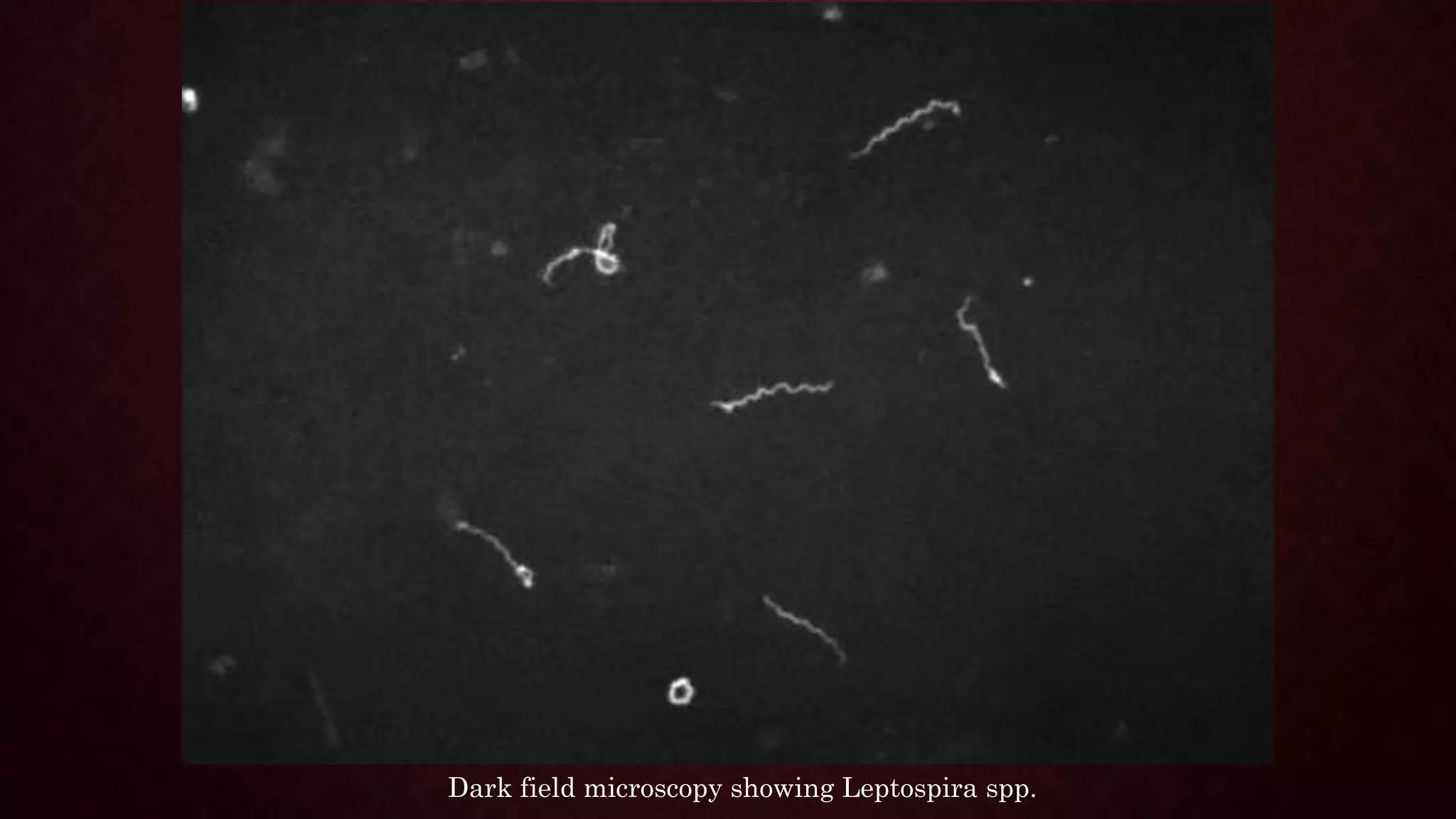 Leptospirosis : update on management | PPTX