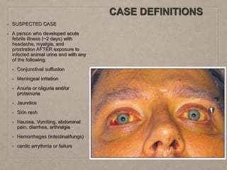 Leptospirosis IEC - Quezon City Health Department | PPT