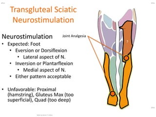 Lower Extremity Nerves Usmle