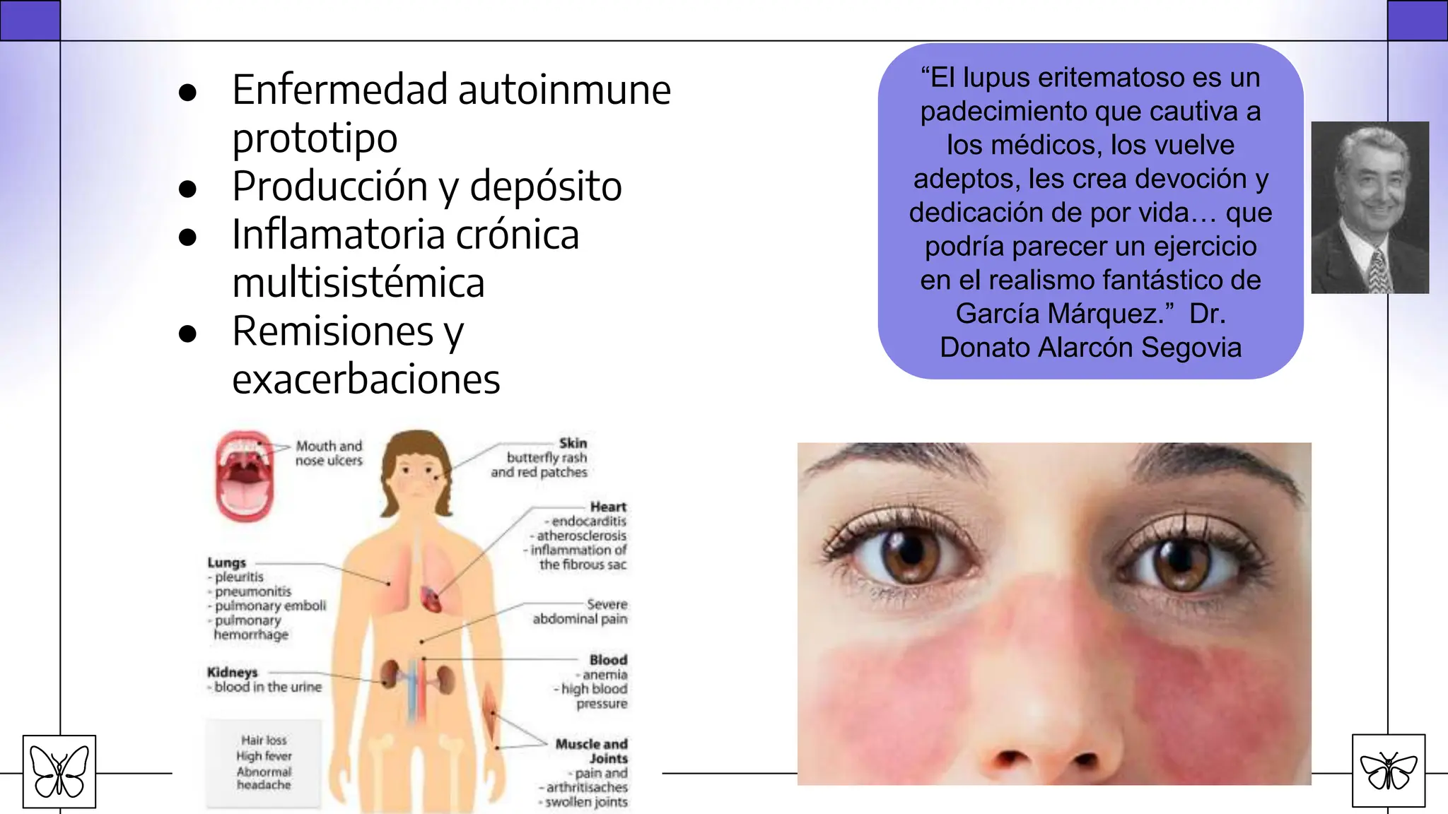 lupus eritematoso sistemico agudo y sus manifestaciones clinicas | PPT