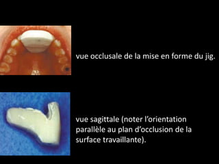 les articulateurs et les arcs faciaux | PPTX