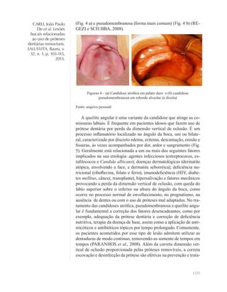 Lesões bucais associadas ao uso de prótese | PDF