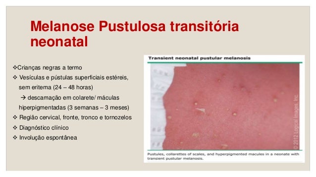 Lesões Cutâneas do RN