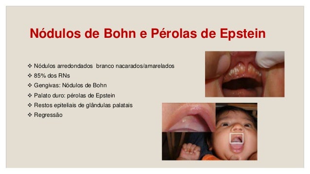 Lesões Cutâneas do RN