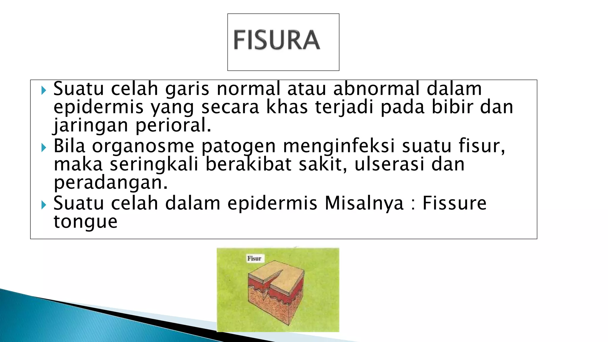 Lesi dasar mulut | PPTX