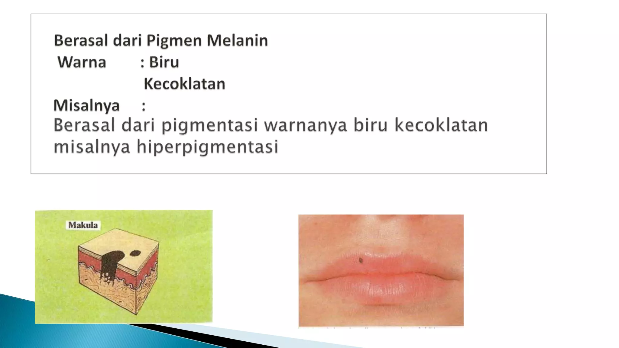 Lesi dasar mulut | PPTX