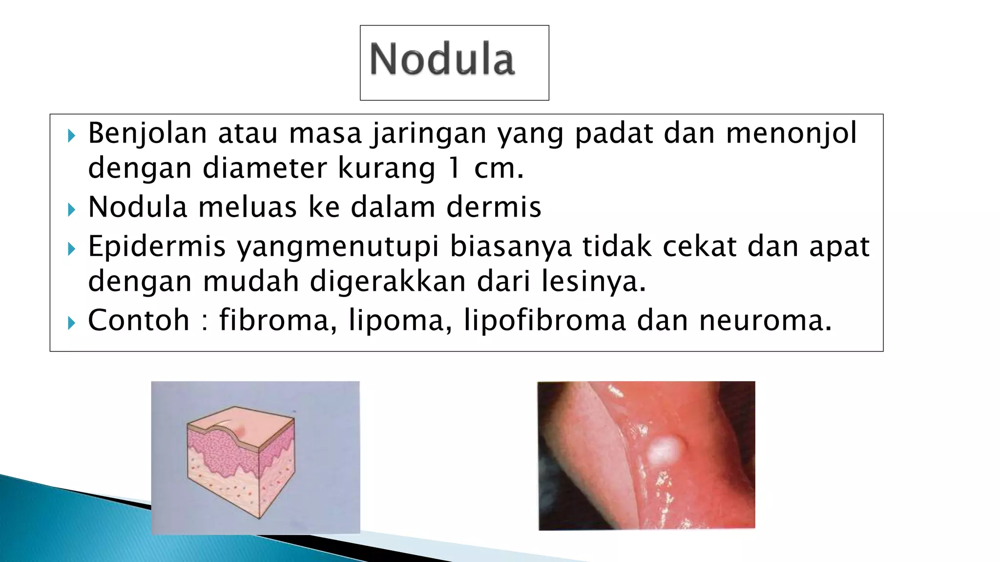 Lesi dasar mulut | PPTX