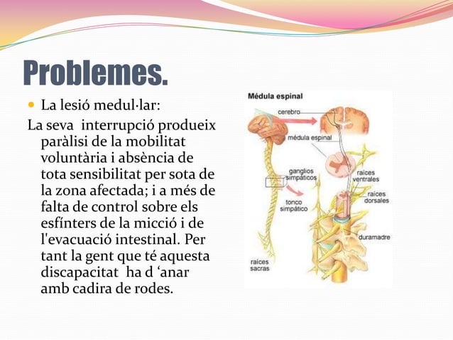 Lesió medul·lar | PPT