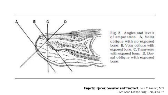 Lesión de la punta de los dedos