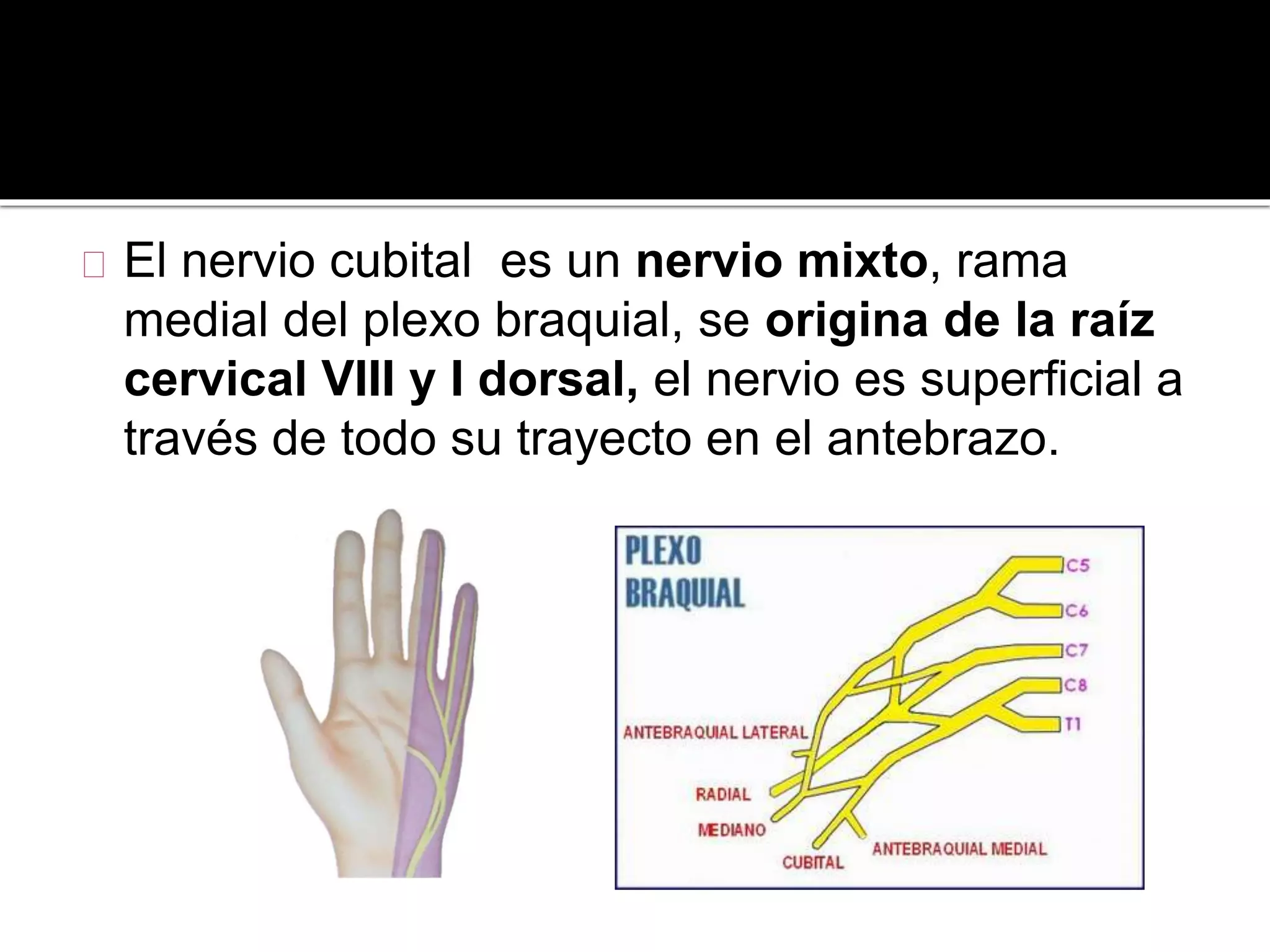 Anatomía Del Nervio Cubital Ppt MANEJO CONSERVADOR NEUROPATIA