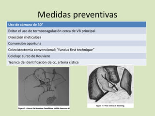Lesión de vías biliares | PPTX