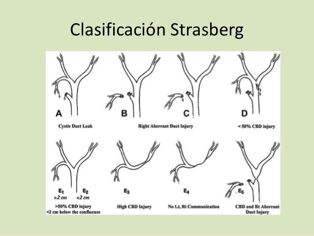 Lesión de vías biliares