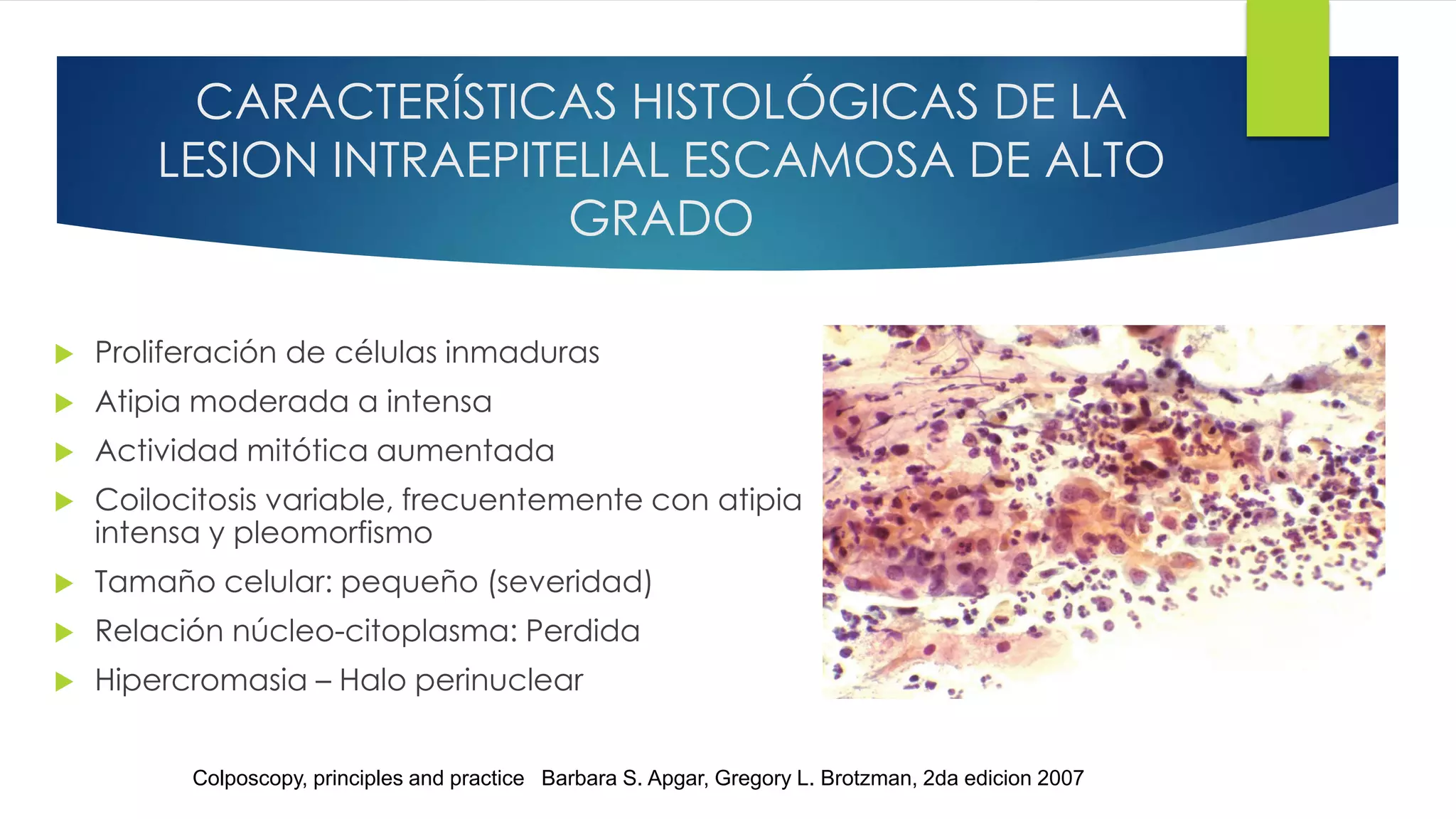 Lesión intraepitelial de alto grado LIEAG - Diagnostico y manejo - vph ...