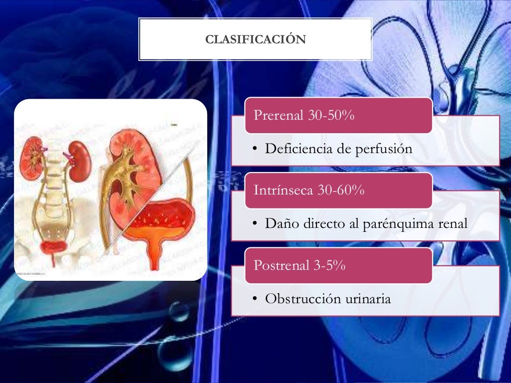 Lesión renal aguda clasificacion AKIN