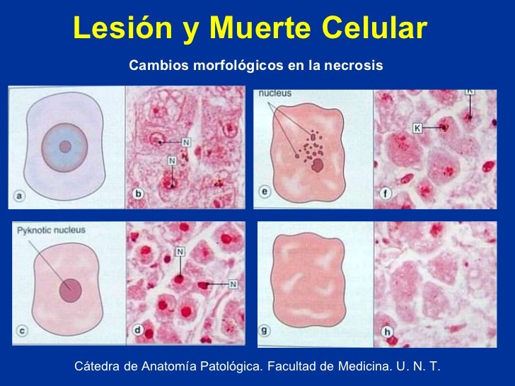 Lesión y muerte celular
