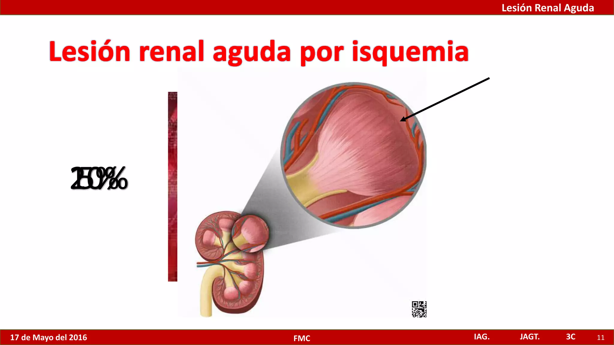 Lesion renal-aguda-1 | PPTX