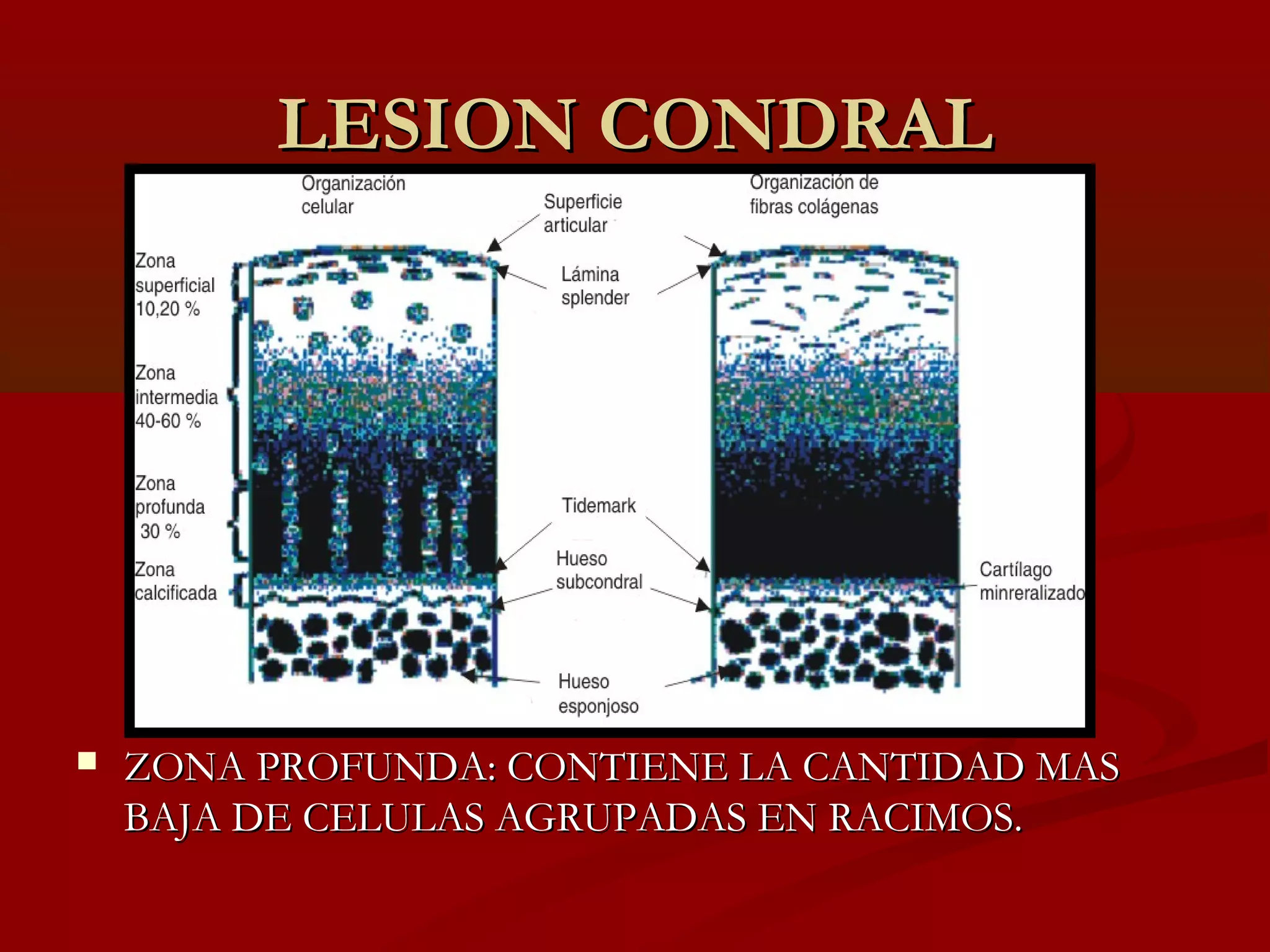 Lesion condral principios y clasificaciones | PPT