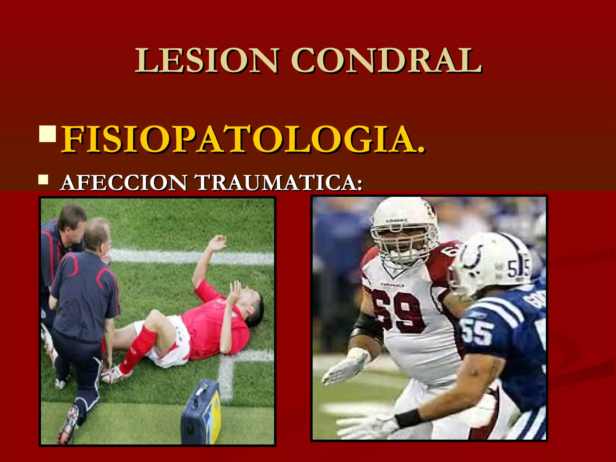 Lesion condral principios y clasificaciones | PPT