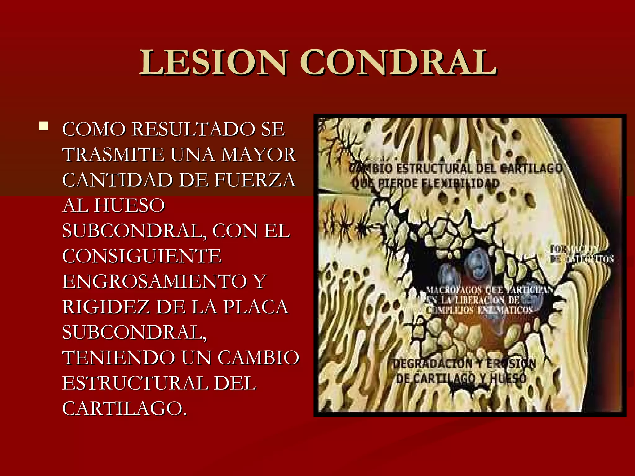 Lesion condral principios y clasificaciones | PPT