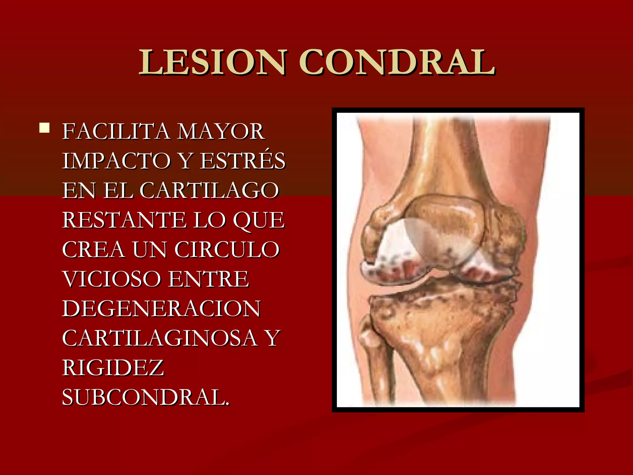 Lesion condral principios y clasificaciones | PPT
