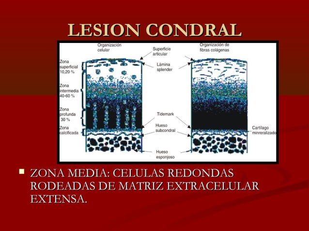 Lesion condral principios y clasificaciones | PPT