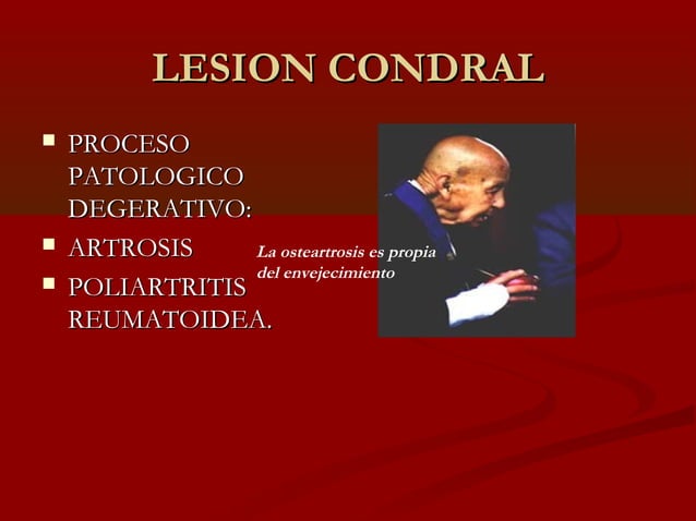 Lesion condral principios y clasificaciones | PPT