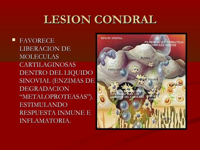 Lesion condral principios y clasificaciones | PPT