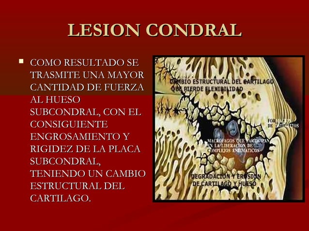Lesion condral principios y clasificaciones | PPT