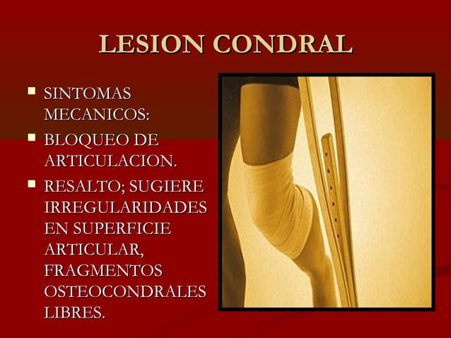 Lesion condral principios y clasificaciones | PPT