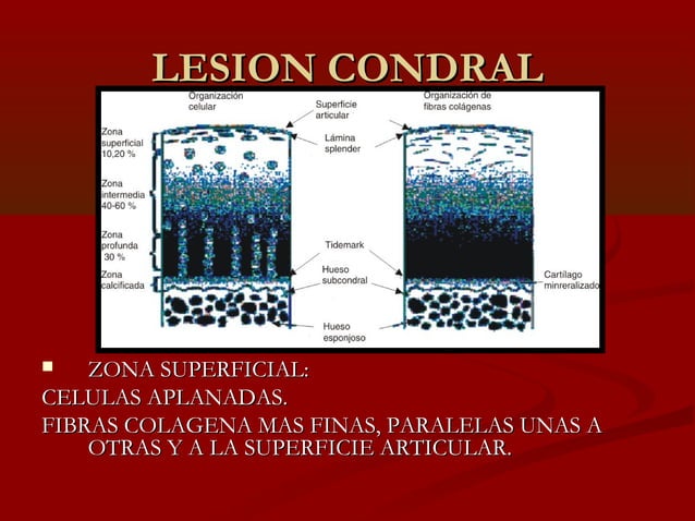 Lesion condral principios y clasificaciones | PPT