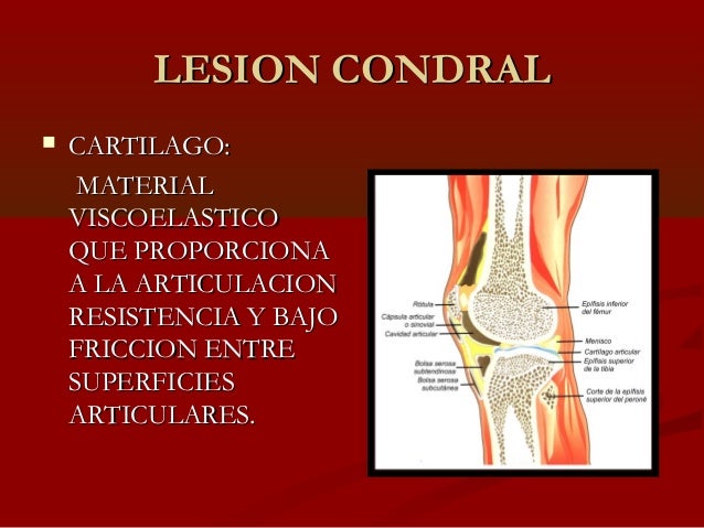 Lesion condral principios y clasificaciones