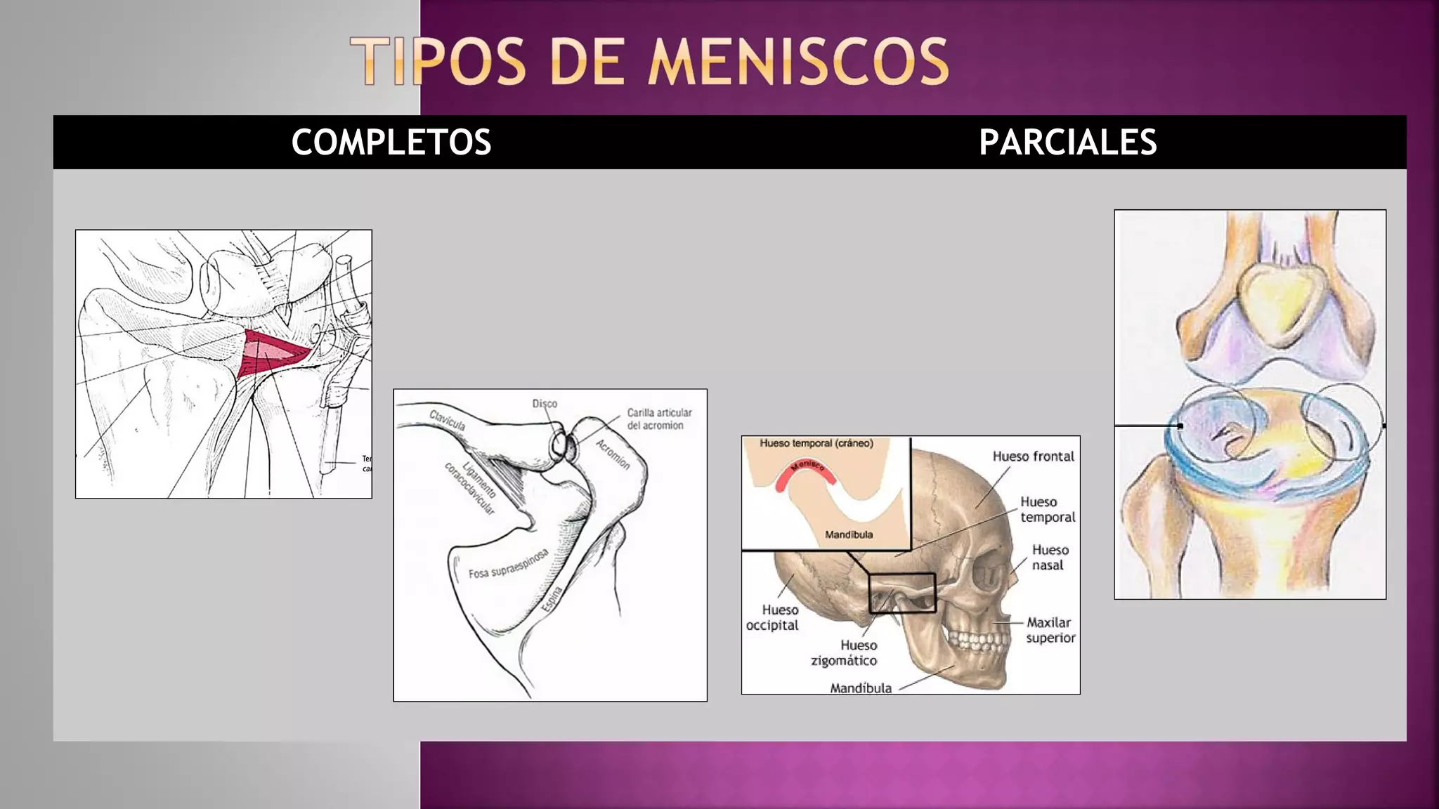 Lesion de meniscos ppt | PPT