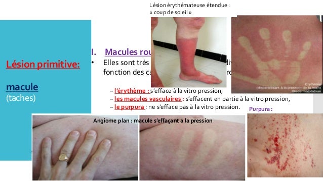les Lesions elementaires en dermatologie