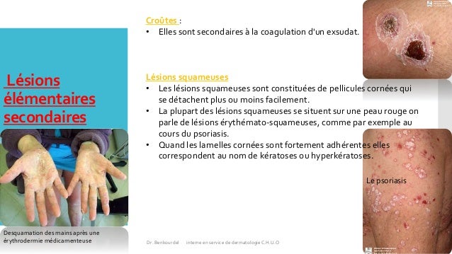 les Lesions elementaires en dermatologie
