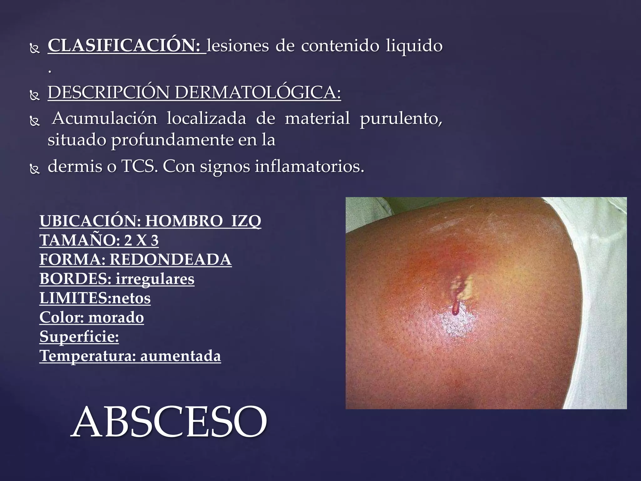LESION ELEMENTAL pptx | PPTX